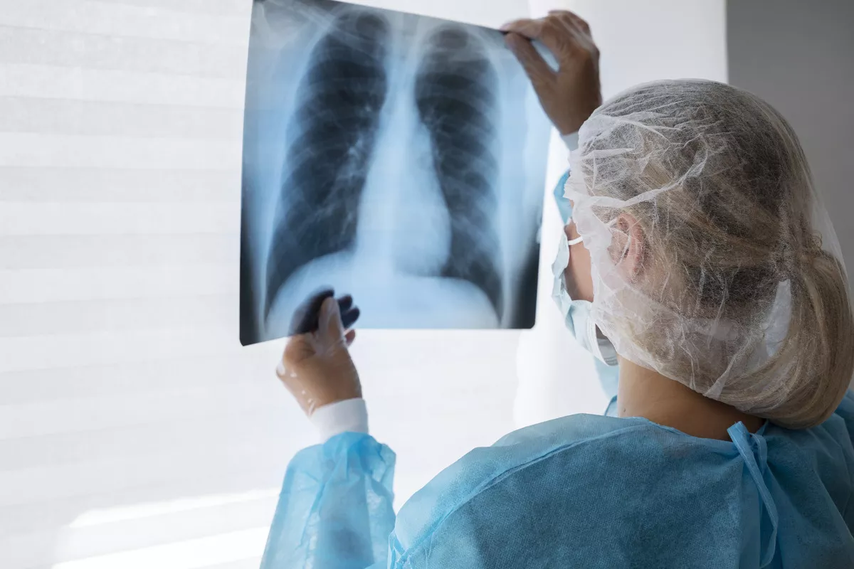 Understanding Pneumothorax (Collapsed Lung): Causes, Symptoms, Treatment, and Recovery | Aster